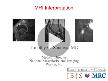 Sanders MRI Interpretation