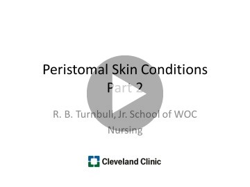 Managing peristomal skin complications part two